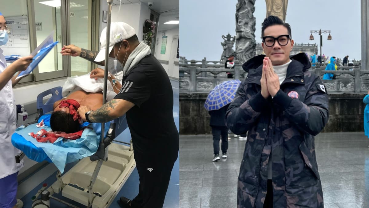 HK actor Jason Wong, who was slashed in the face last year, says his ...