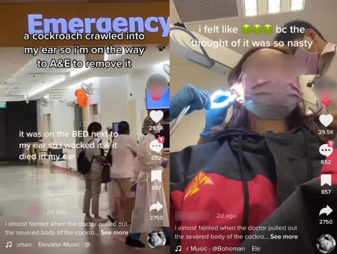 Cockroach Crawled Into Your Ear? Here’s What You Should Do, According ...