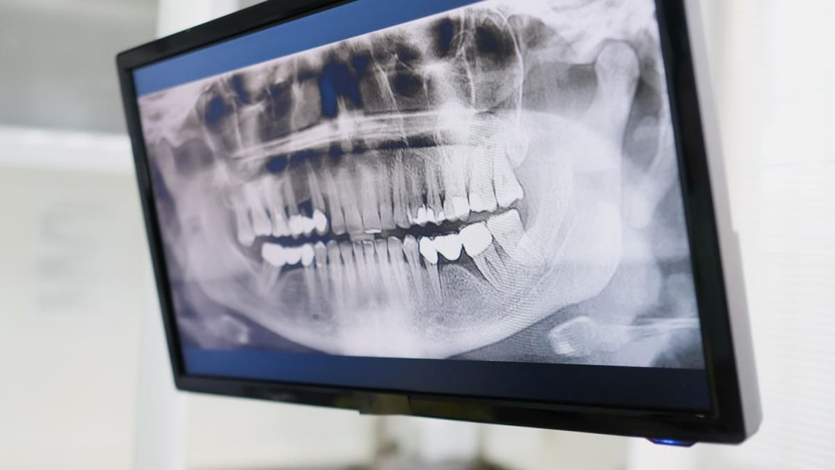 Dentist gets more than 3 years' jail after cheating CPF Board, MOH of S ...