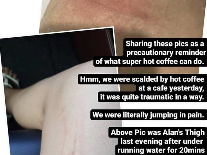 Priscelia Chan And Alan Tern Scalded By Hot Coffee At Cafe; Says It Was ...