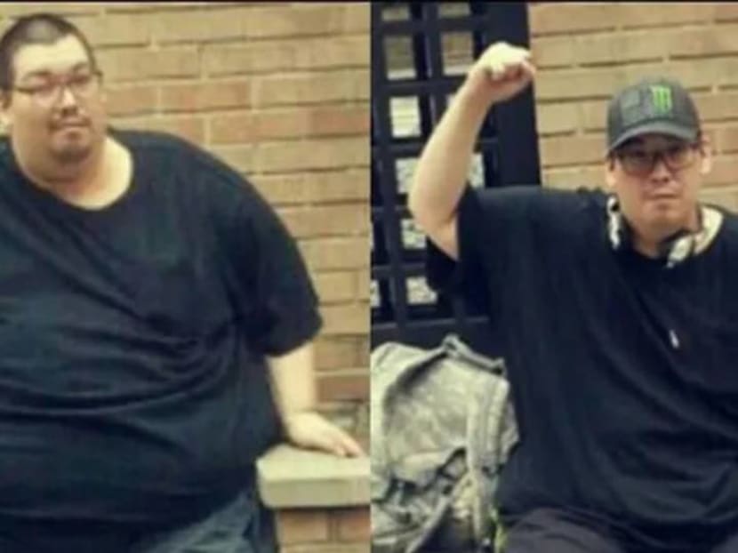 Korean Rapper BIGJO, Who Weighed 320kg, Passes Away During Surgery - TODAY