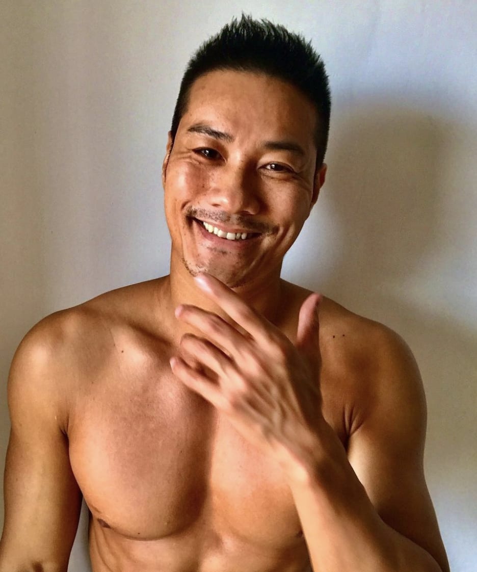 HK Actor Jason Wong, Who Is Often Called A “Louis Koo Knockoff”, Gets 100 Stitches On Face After ...