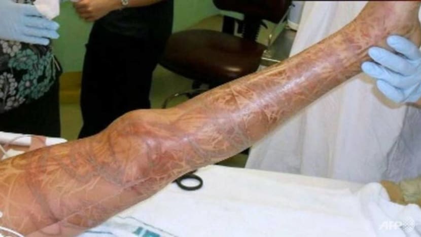 Under the sea: What you need to know about the dangerous box jellyfish ...