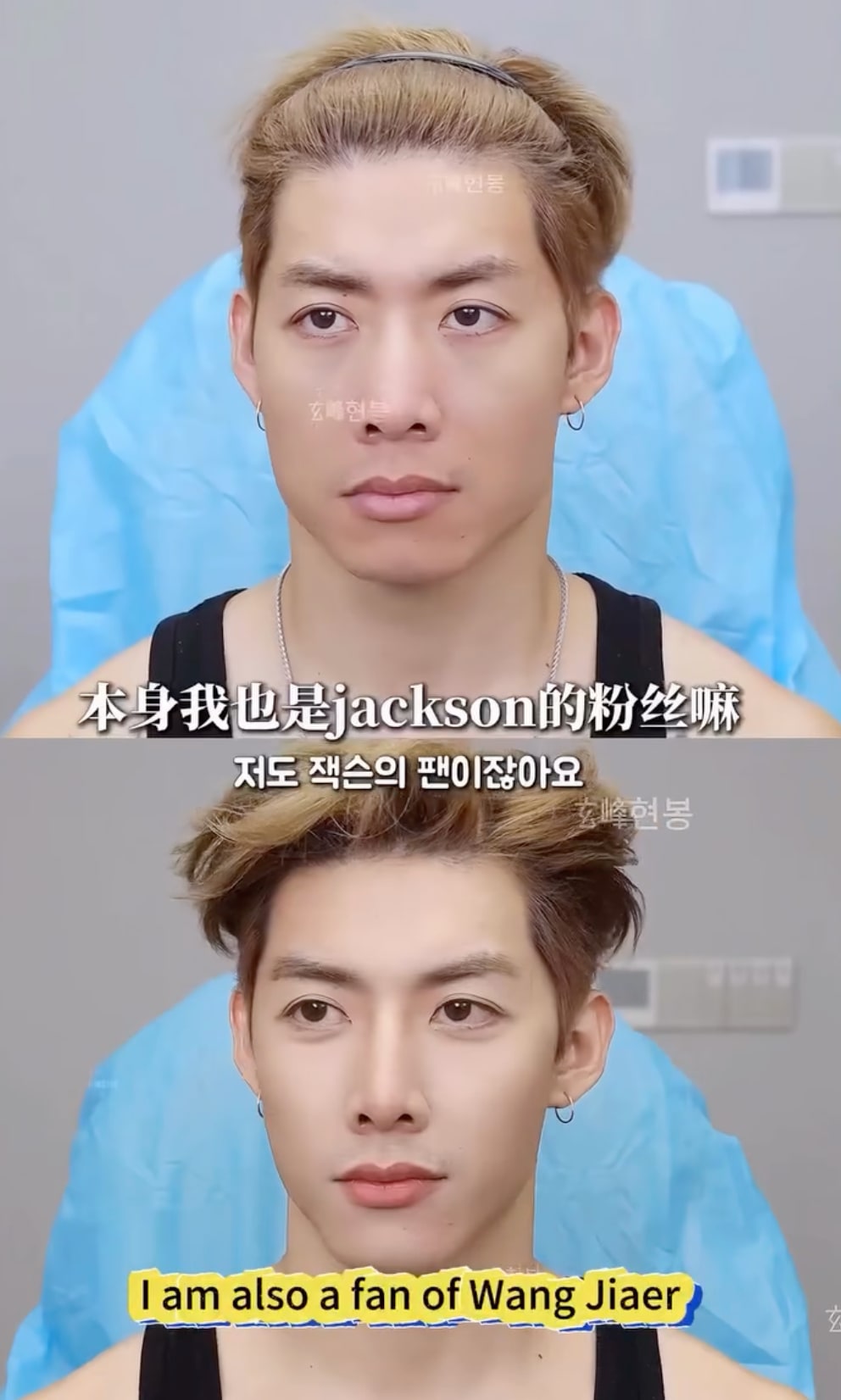 wang jiayun plastic surgery