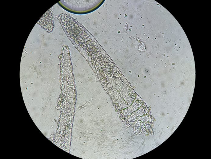 eyelash extensions under microscope