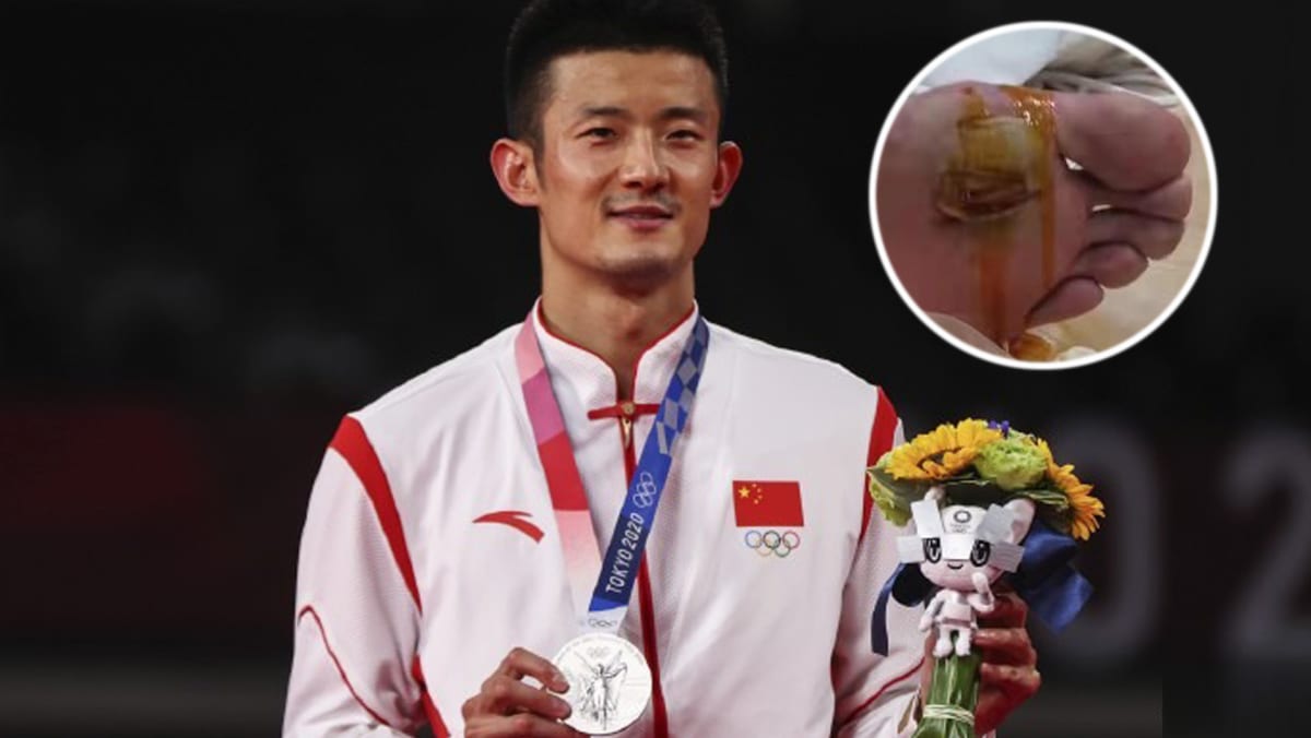 Chinese Olympic Shuttler Chen Long Was Called “Useless” For Not Winning ...
