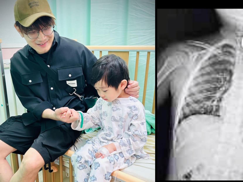 4-year-old son of Taiwanese singer accidentally swallowed a coin and it ...