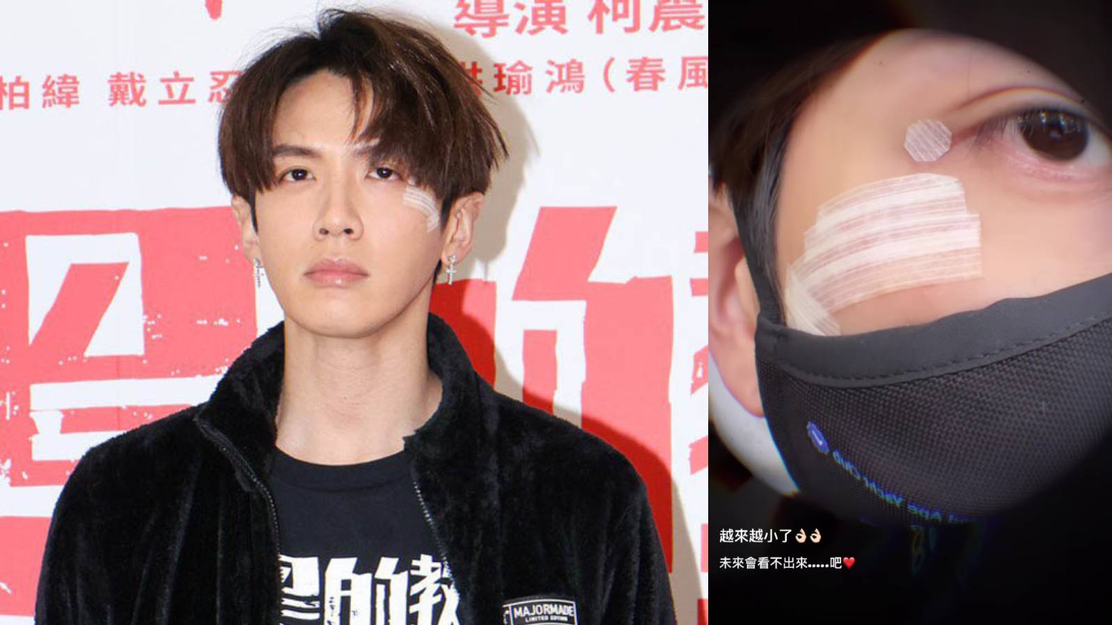 Kai Ko Feels Scared Whenever He Sees Spinning Objects, Two Months After ...