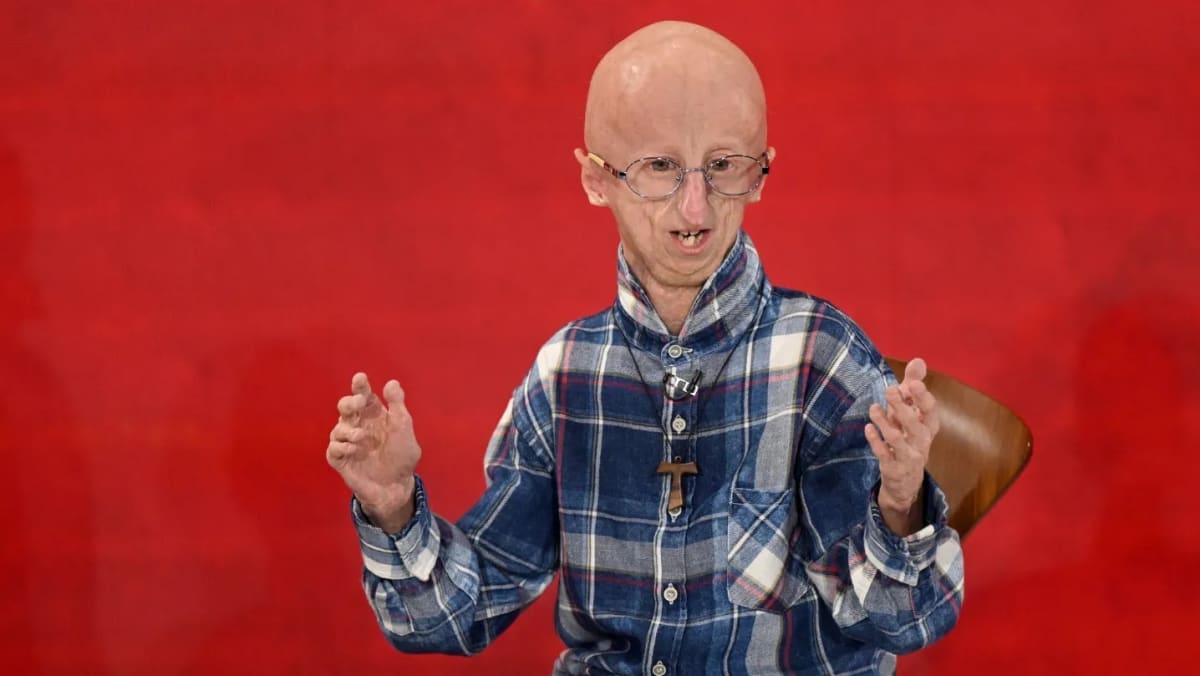 Survivor of rare rapid-ageing disease progeria dies at 28 - CNA