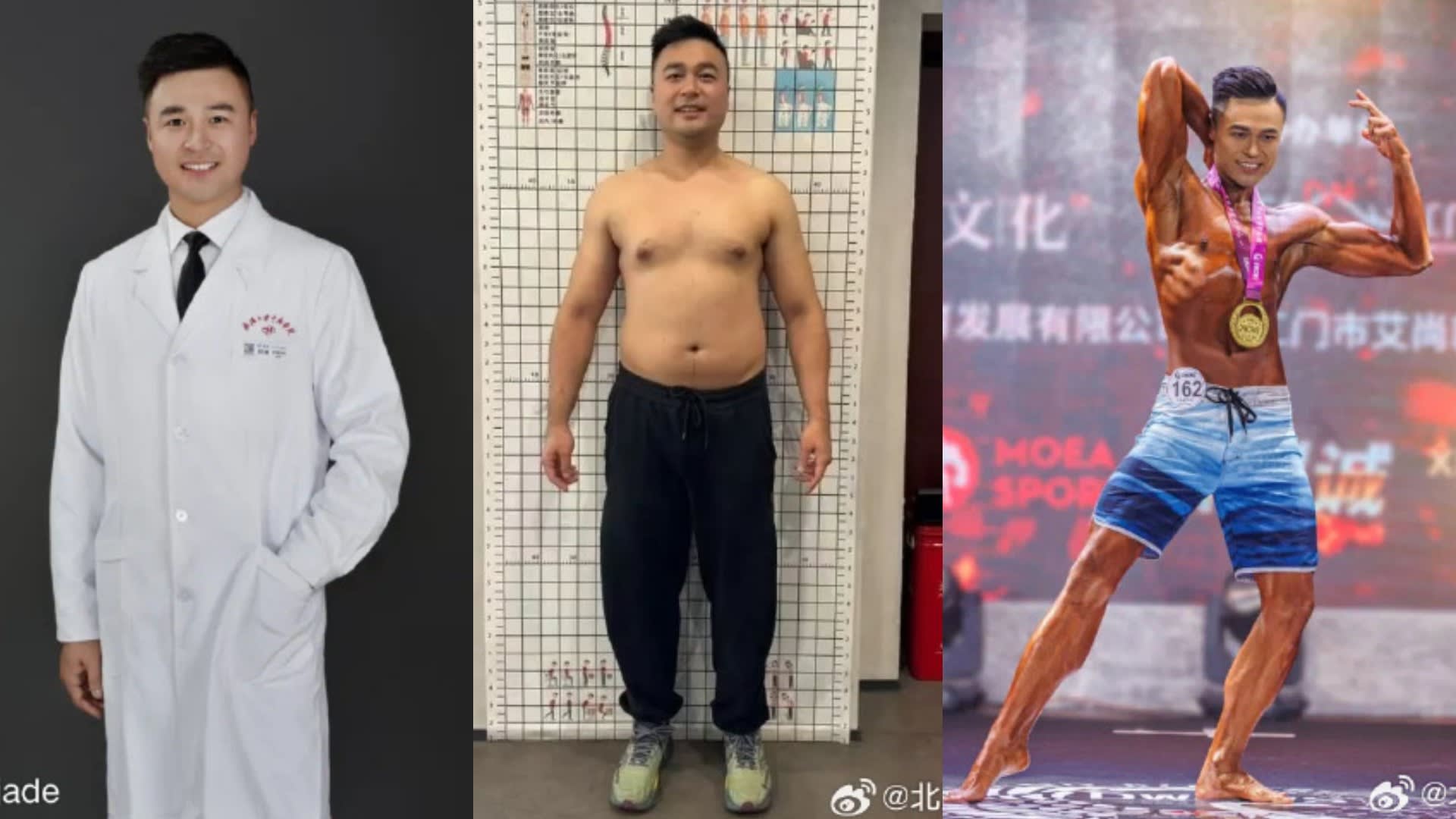 Doctor Loses 25kg In 42 Days; Wins Awards At Bodybuilding Competition ...