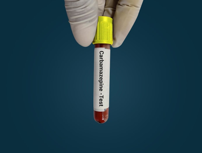 Electric shock facial pain? A rare condition called trigeminal ...