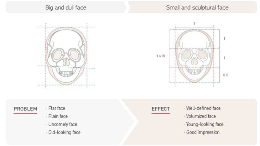 asian face bone structure