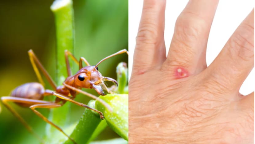 Semut api, tebuan, pepijat: Nak buat apa jika digigit atau disengat ...