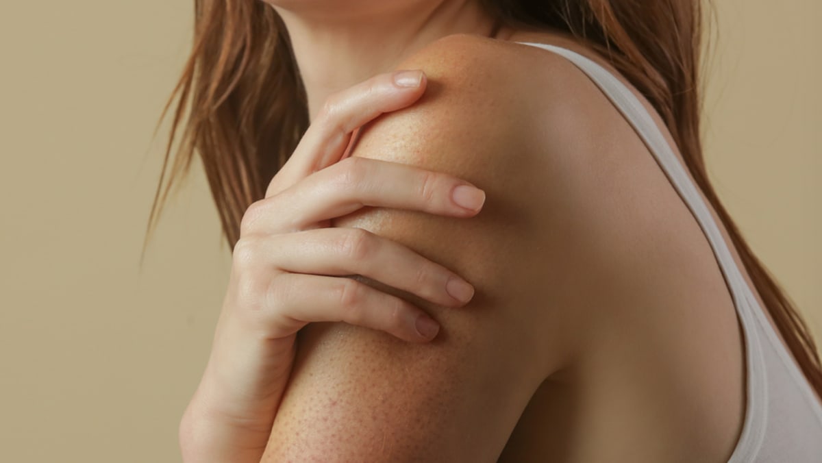 ‘Chicken skin’: How to treat rough, bumpy patches on arms and thighs ...