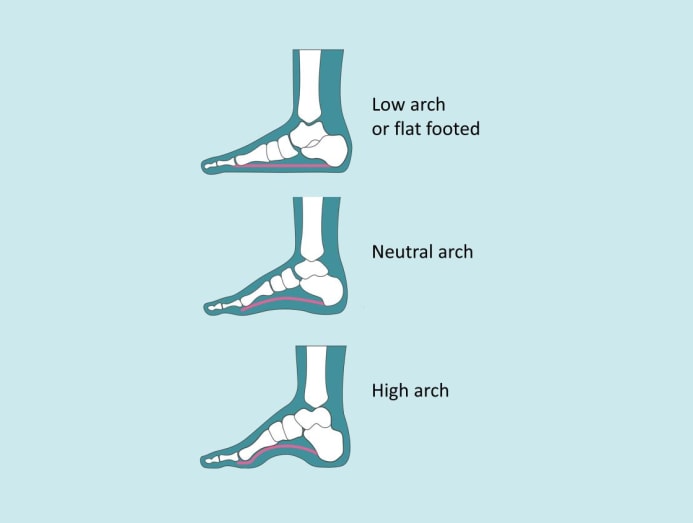 running foot types