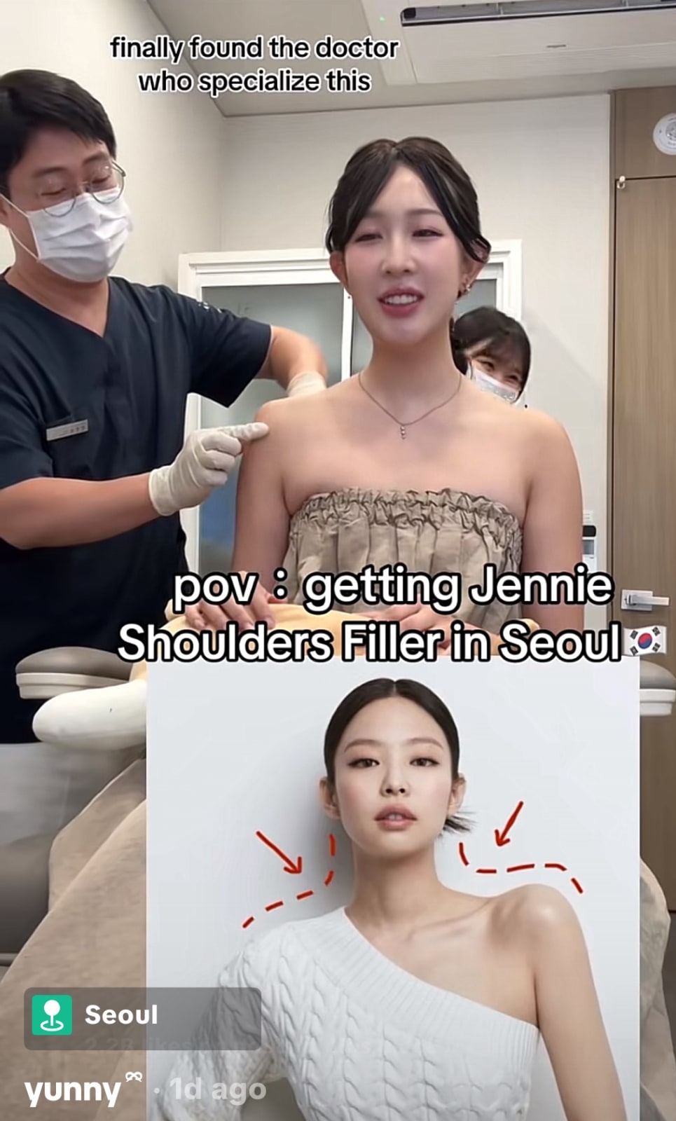 Korean Woman Gets Shoulder Fillers To Achieve Blackpink Jennie’s “90 ...