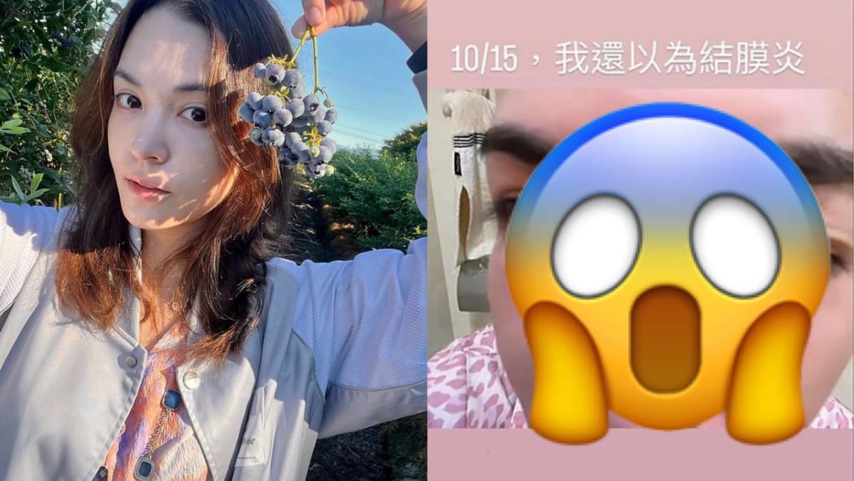 Taiwanese Actress Sandrine Pinna Had An Allergic Reaction So Bad, It ...