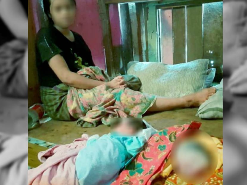 Woman gives birth to baby with no body in Sabah - TODAY