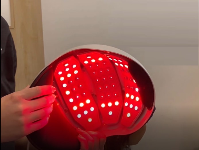 The TCM approach: Uncovering the causes of hair and scalp troubles