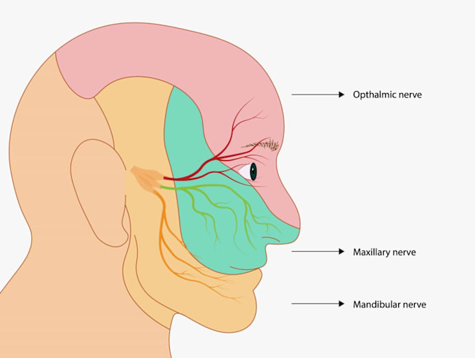 trigeminal nerve problems