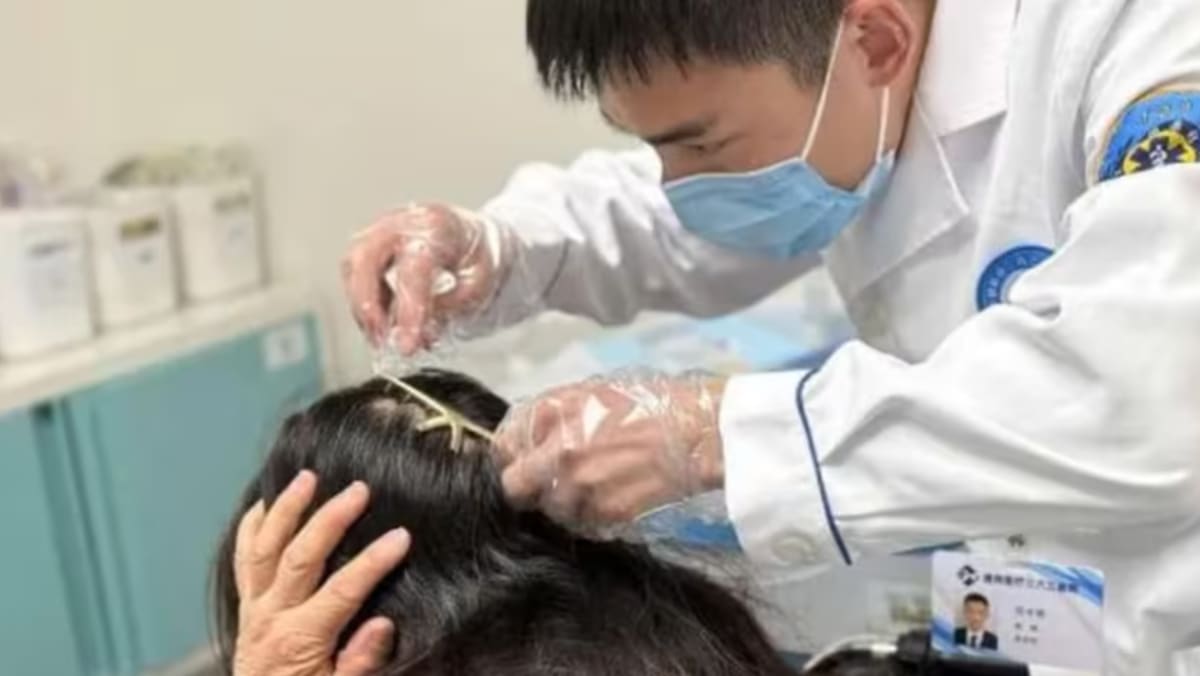 Sepit rambut wanita tercacak pada kepala susuli nahas jalan raya di ...