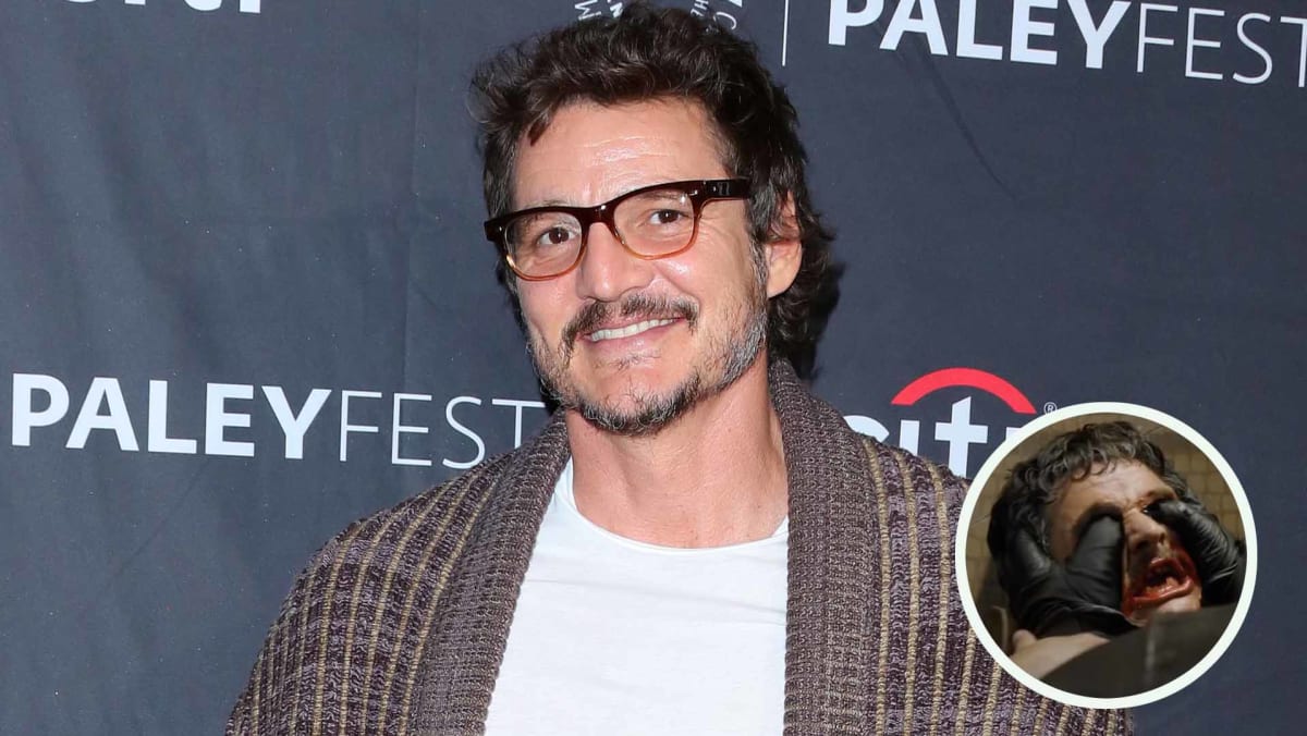 Pedro Pascal got eye infection from a fan when recreating his gruesome ...