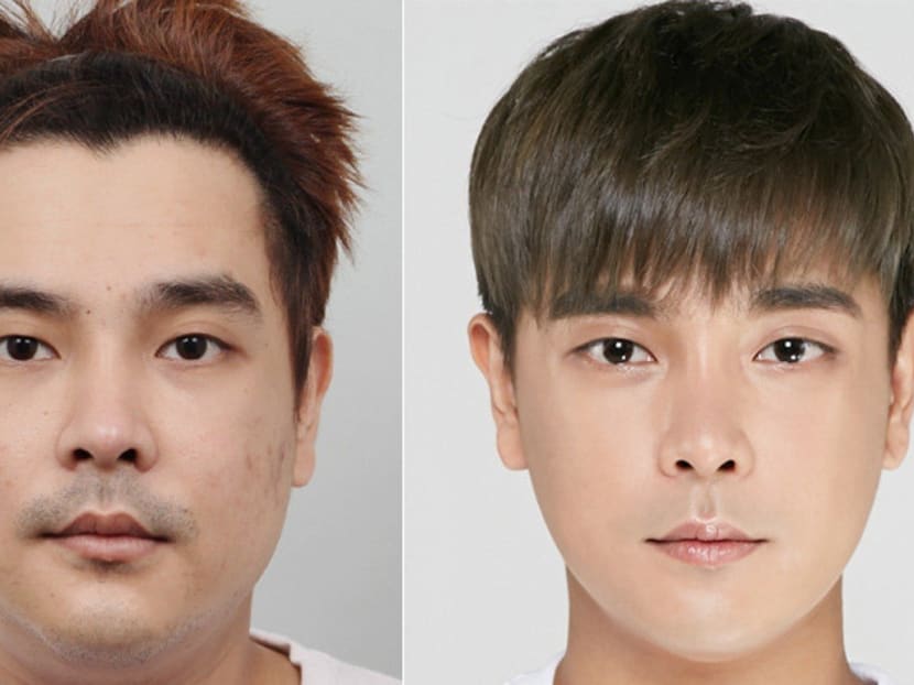 Asian face surgery store