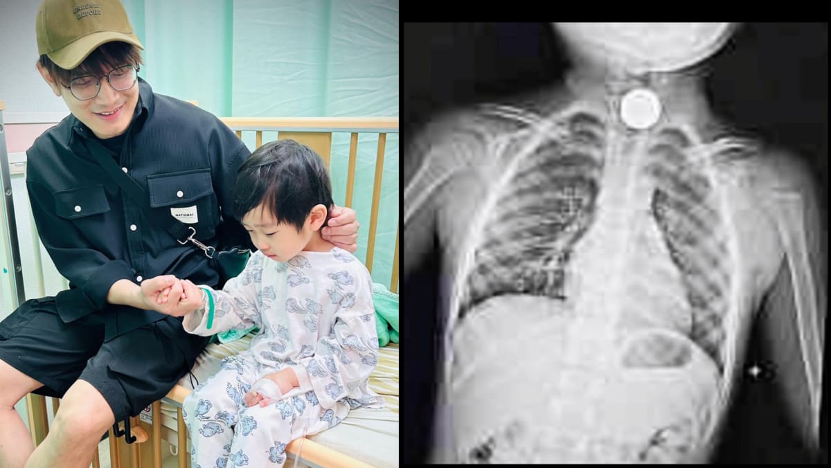 4-year-old son of Taiwanese singer accidentally swallowed a coin and it ...