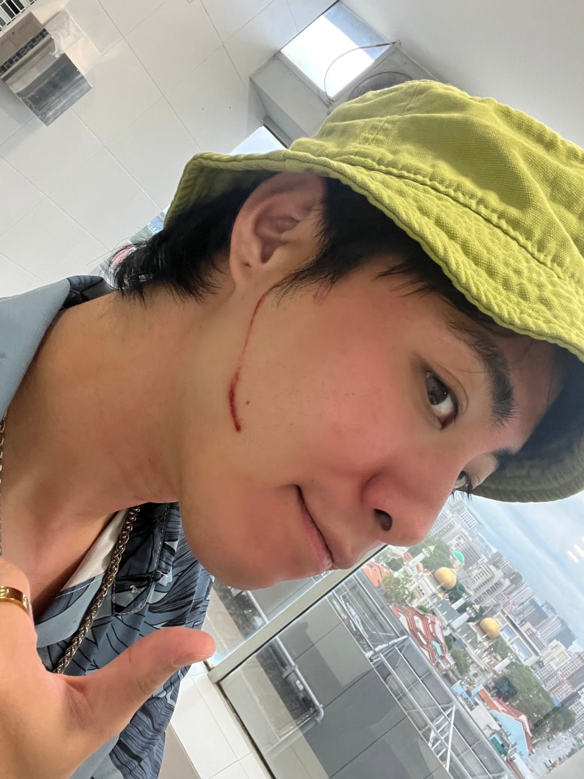 “I Think I Look Quite Badass Now”: Zong Zijie Gets 10cm Cut On His ...