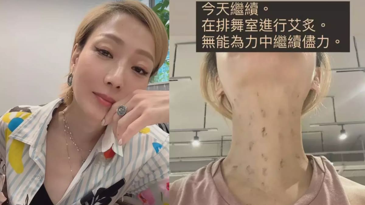 Sammi Cheng shares picture of neck after TCM therapy, says she’s ...