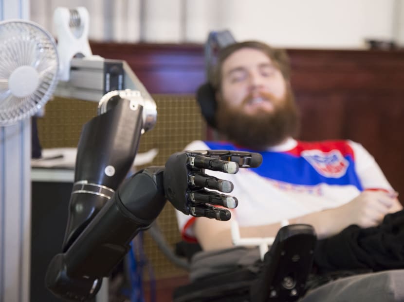 New sensation: Pioneering mind-controlled arm restores sense of touch ...