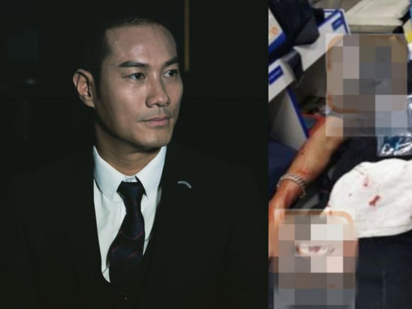 HK Actor Jason Wong, Who Is Often Called A “Louis Koo Knockoff”, Gets ...