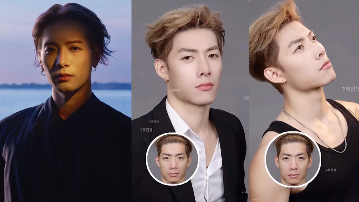 wang jiayun plastic surgery