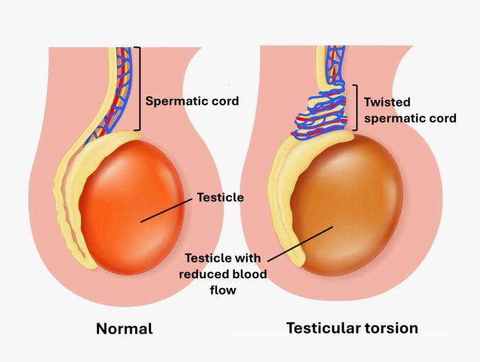 testis problems and solutions