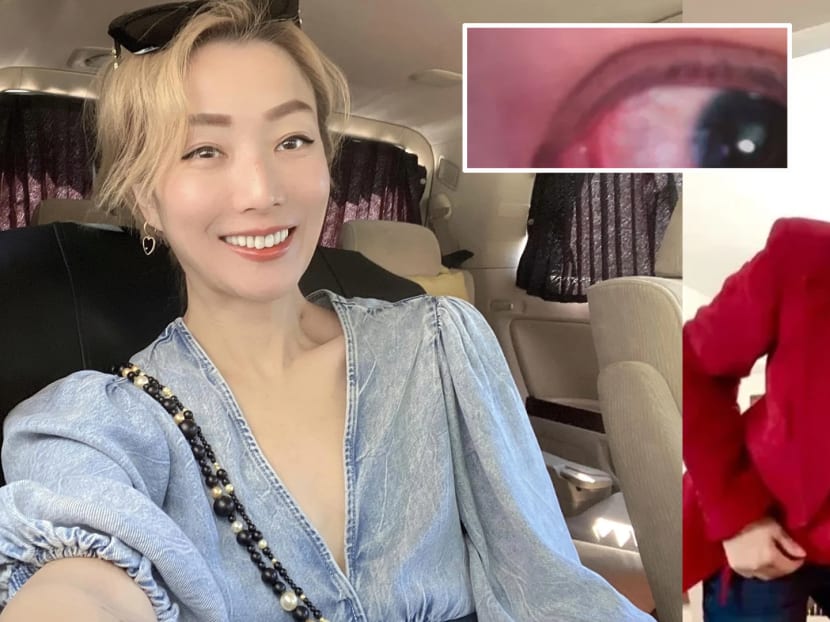 Sammi Cheng accidentally uses silicone bra cleaner as make-up remover ...